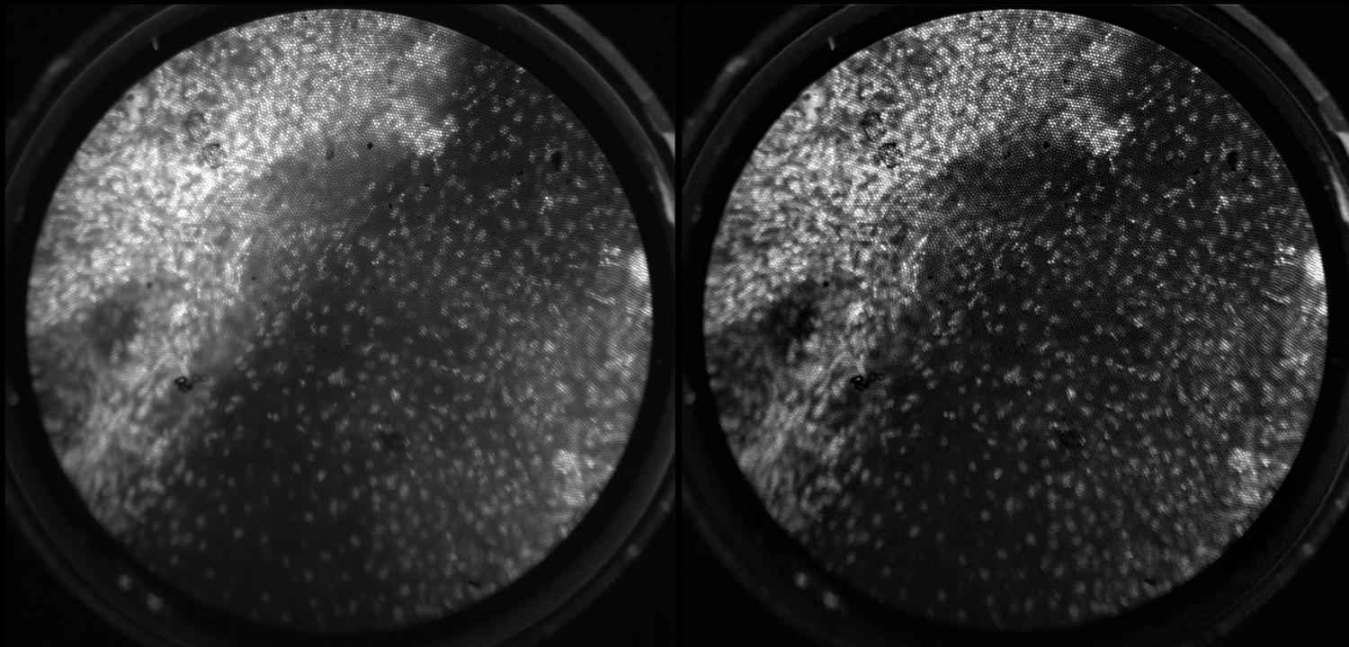 Improved Microendoscope Brings Cervical Cancer into Focus - Research ...