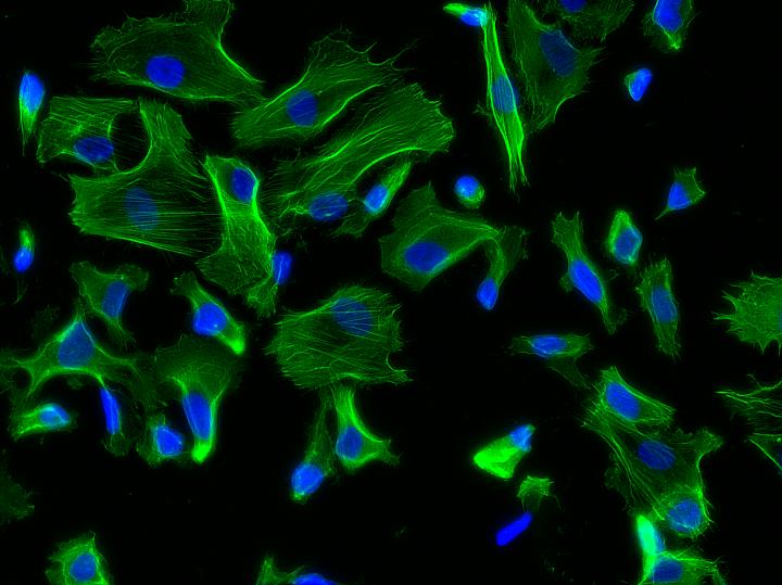 Organ-On-a-Chip Model Offers Insights into Premature Aging and Vascular ...