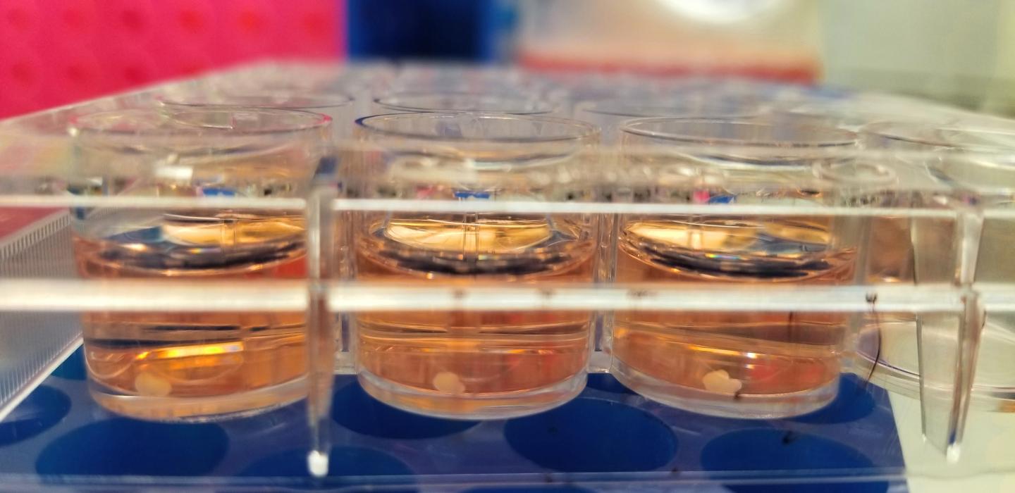 A New Milestone in Laboratory Grown Human Brain Tissue - Research ...