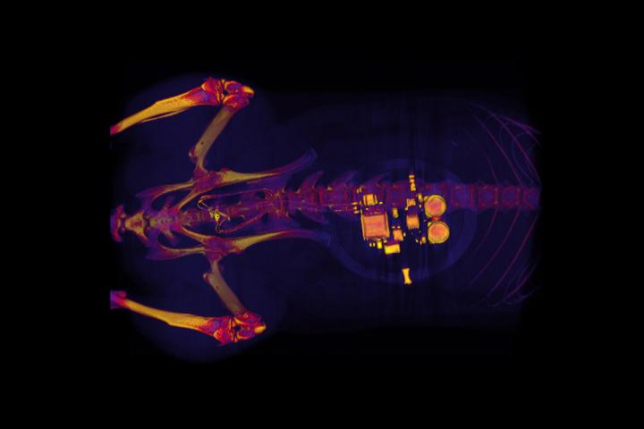 Tiny, Implantable Device Uses Light to Treat Bladder Problems ...