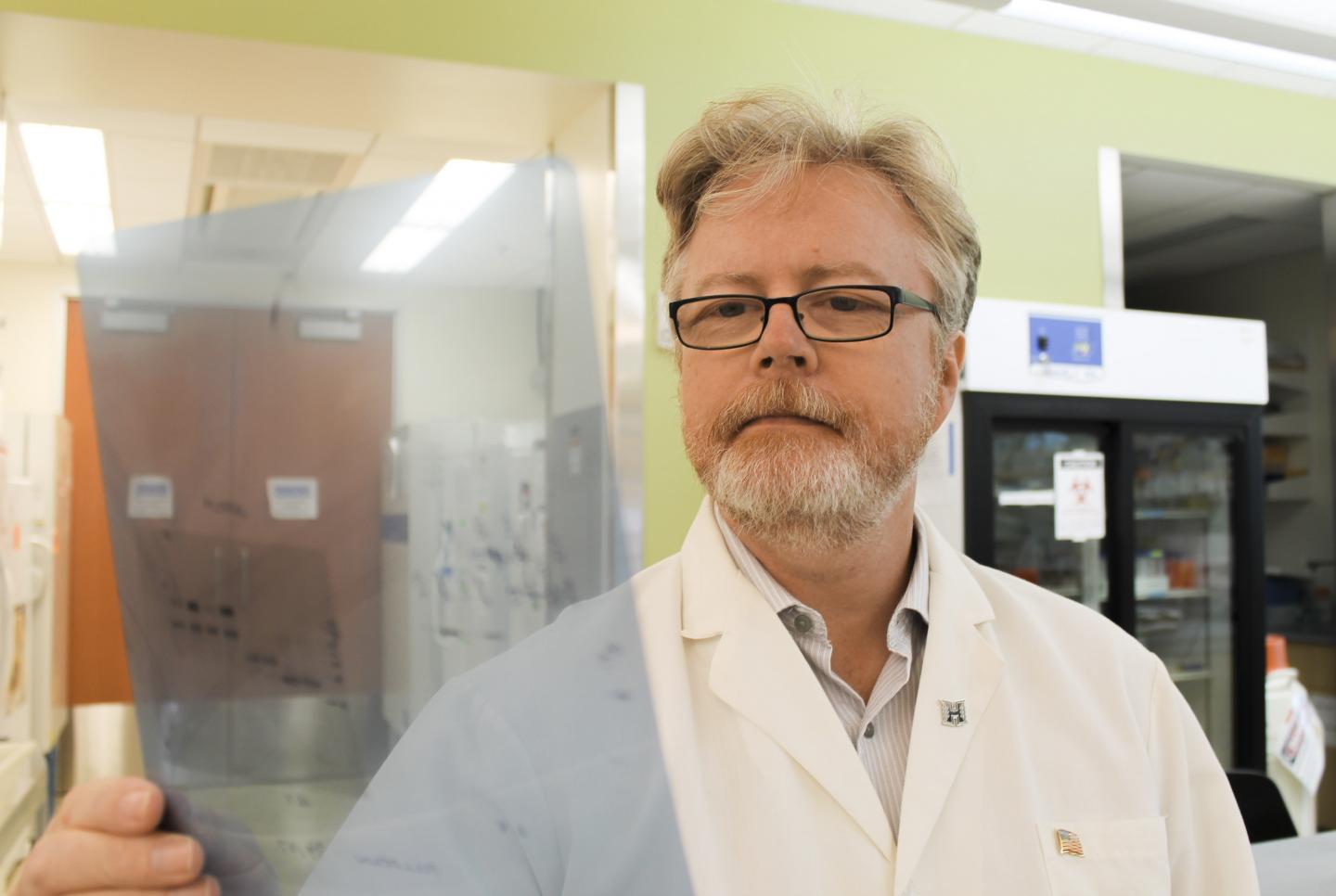 Researcher Finds New Driver of Aggressive Form of Brain Cancer ...