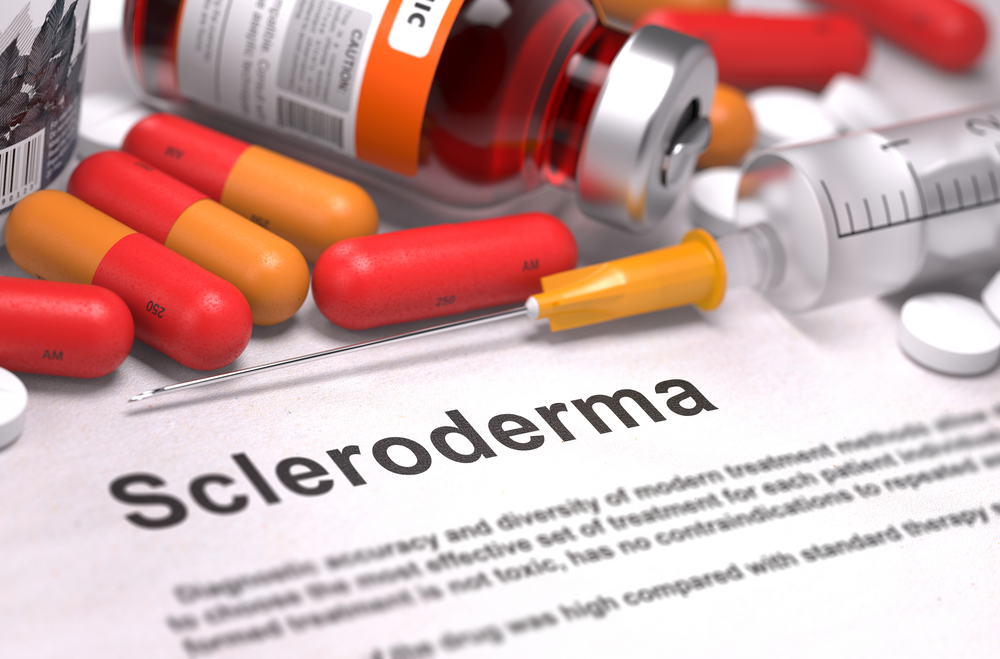 New Study Suggests Way to Slow Skin Fibrosis in Scleroderma - Research ...