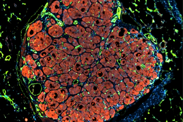 New Engineered Liver Tissue Could Improve Transplants - Research ...