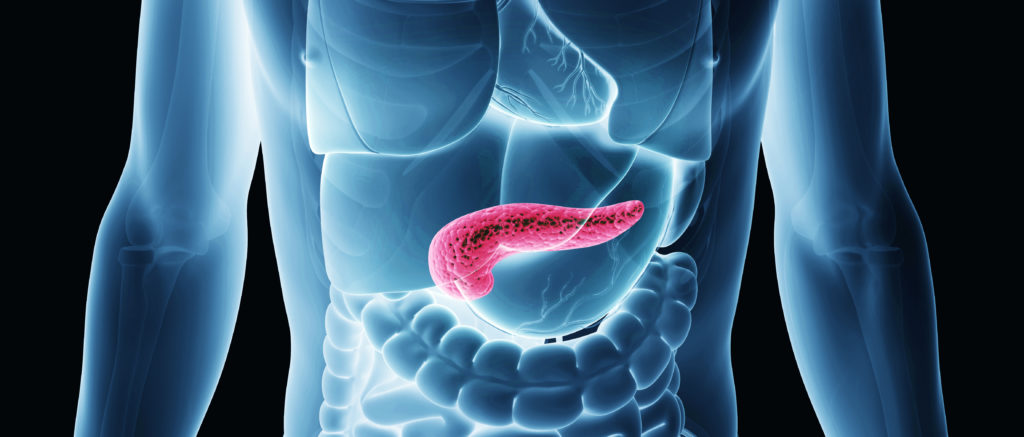 Bilirubin-Loaded Capsules Increase Survival of Transplanted Pancreatic ...