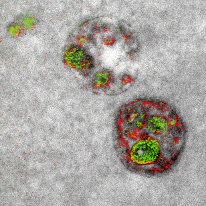 First Multicolor Electron Microscopy Images Revealed - Research ...