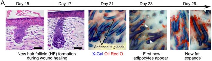 Using Fat to Help Wounds Heal Without Scars - Research & Development World