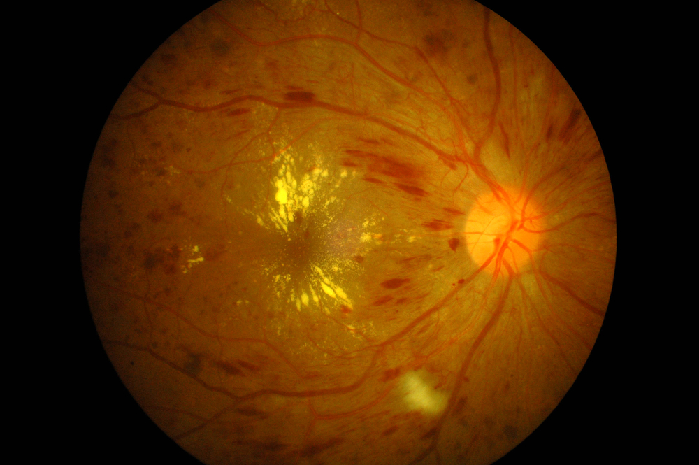 Reproducing Retinal Disease on a Chip - Research & Development World