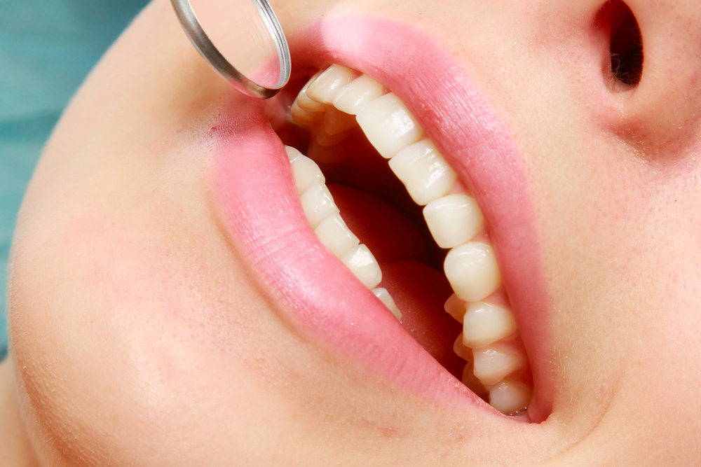 Plaster Which Sticks Inside the Mouth Will Revolutionize Treatment of ...