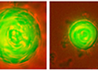 Artificial cells help scientists study molecular crowding, gene ...