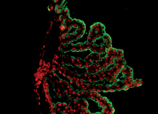 Scientists identify the signature of aging in the brain - Research ...