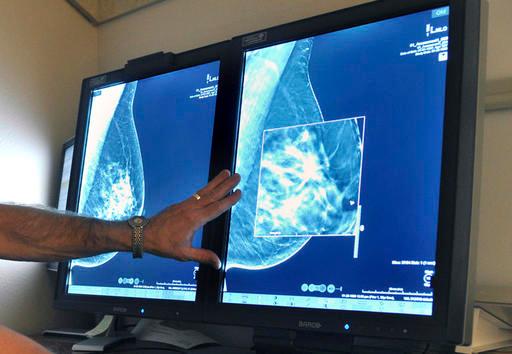 Study Questions Value of Mammograms, Breast Cancer Screening - Research ...