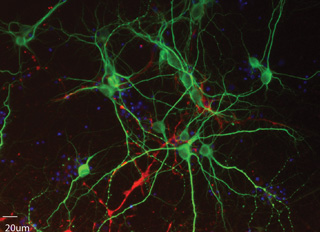 Microfluidic Method for Primary Neuron Culture and Analysis - Research ...