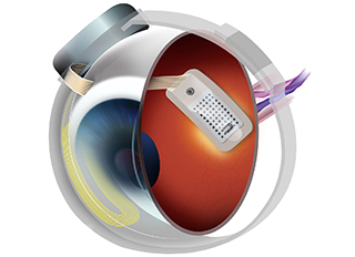 How to Build a Brain-machine Interface - Research & Development World