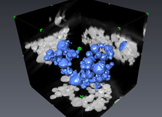 New modeling approach transforms imaging technologies - Research ...