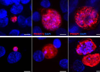 New source of cells for modeling malaria - Research & Development World