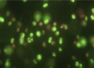 Study: Microalgae produce more oil faster for energy, food, or products ...