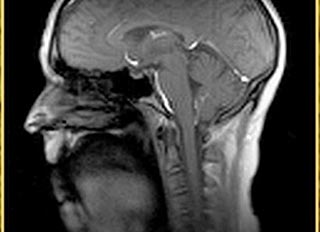 Super-Fast MRI Technique shows what it looks Like to Sing 'If I Only ...