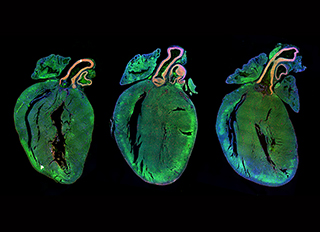 Rat Heart Sections - Research & Development World