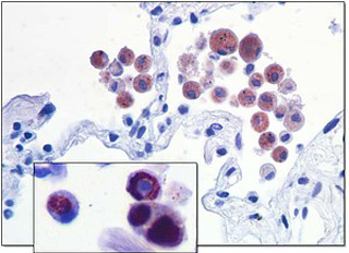 A new “hope” for preservation of tissue samples for analysis - Research ...