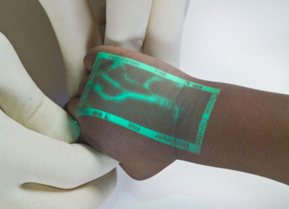 A Better Way to Find Veins - Research & Development World
