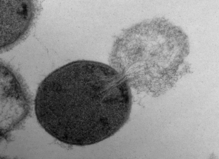 Study quantifies the size of holes antibacterials create in cell walls ...