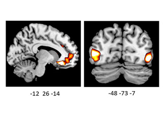 Genes influence brain reaction to emotional information - Research ...