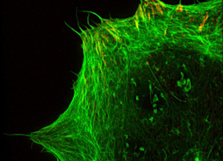 Spinning-disk microscope offers window into a cell’s core - Research ...