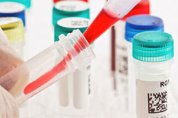 Quality Control Kits for Proteomics - Research & Development World