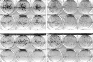 Metformin Effectiveness Depends on Glucose - Research & Development World
