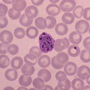 Malaria Discovery May Aid Vaccine Design - Research & Development World