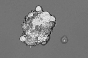 Researchers Identify New Ways to Drain Cancer's 'Fuel Tank' - Research ...