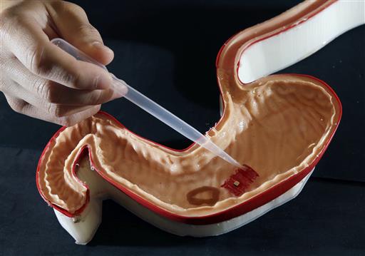 Stomach Troubles? Try Swallowing an Origami Robot - Research ...