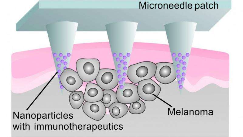 Microneedle Patch Delivers Localized Cancer Immunotherapy to Melanoma ...