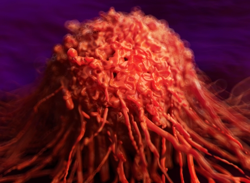 Cancer Cells' Evasive Action Revealed - Research & Development World