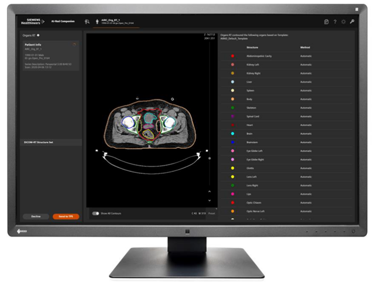 R&D 100 winner of the day: AI-Rad Companion Organs RT - Research ...