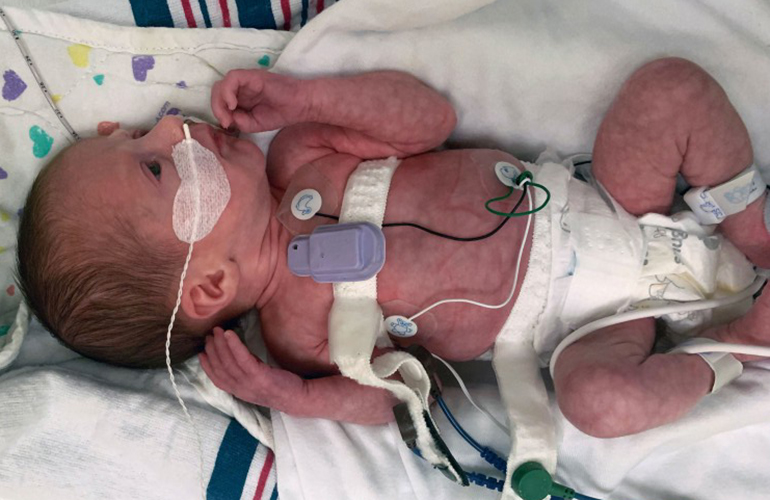 Researchers develop first wearable for continuous monitoring of body ...