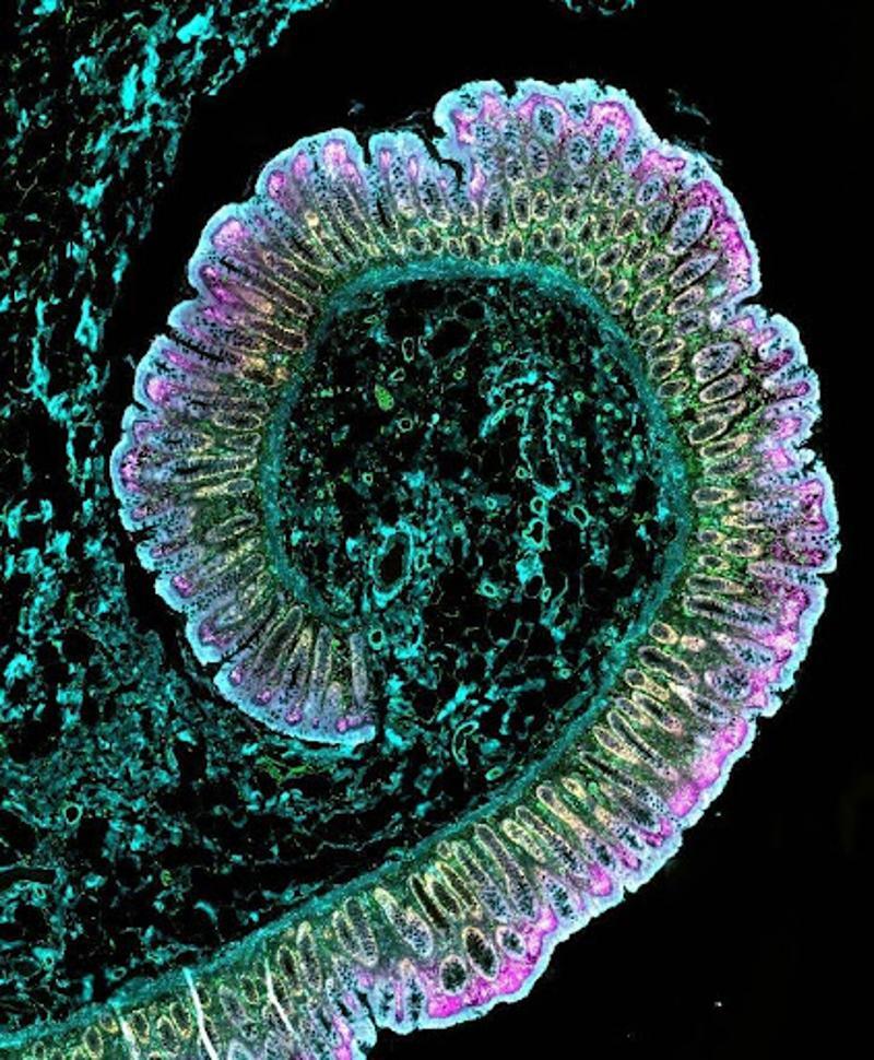 Spatial biology in focus: a 12-image deep dive
