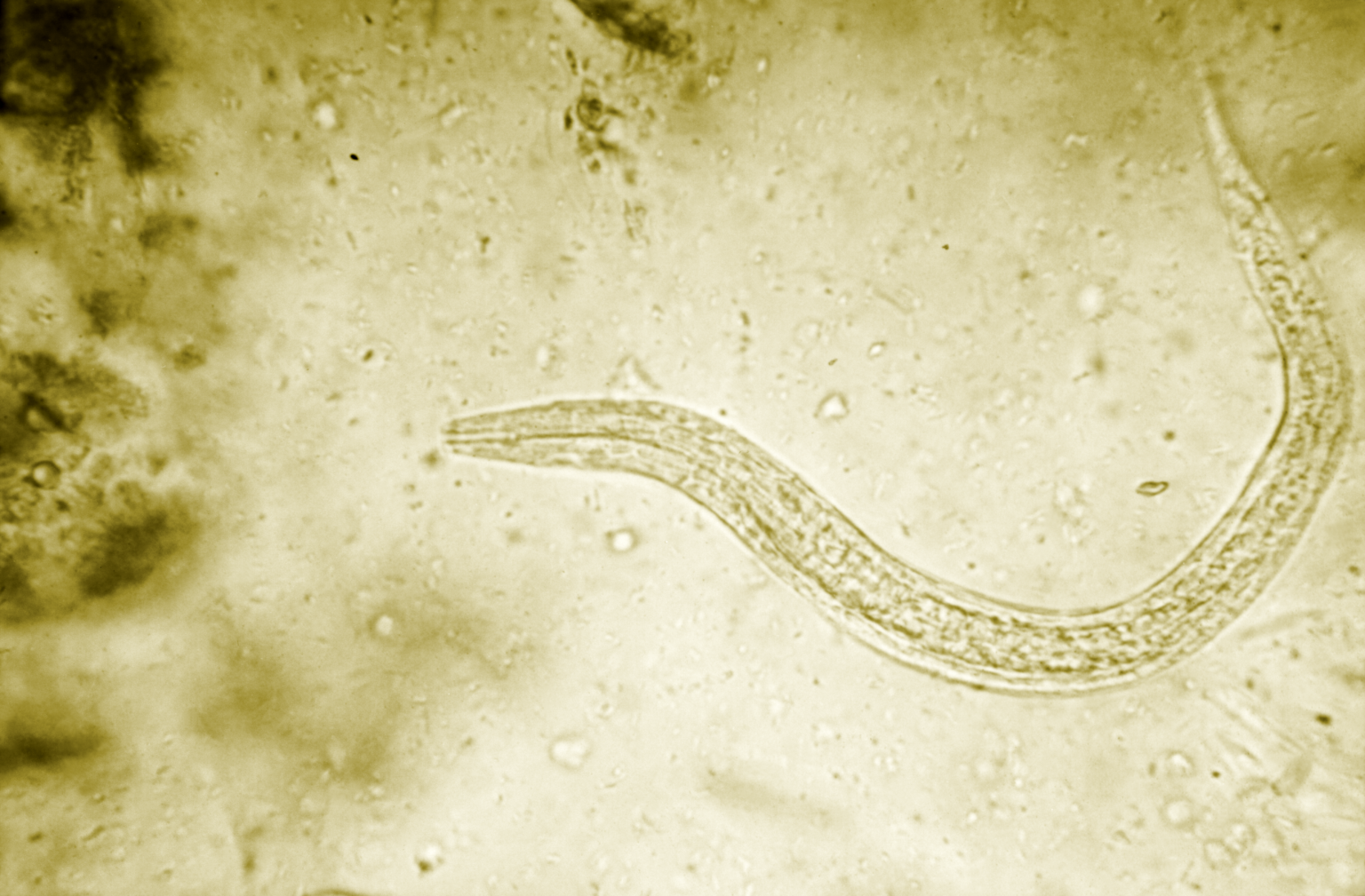 Genetically modified hookworms could make therapeutics in a host