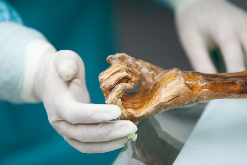 How the Iceman exposed the blind spots of pure metagenomics