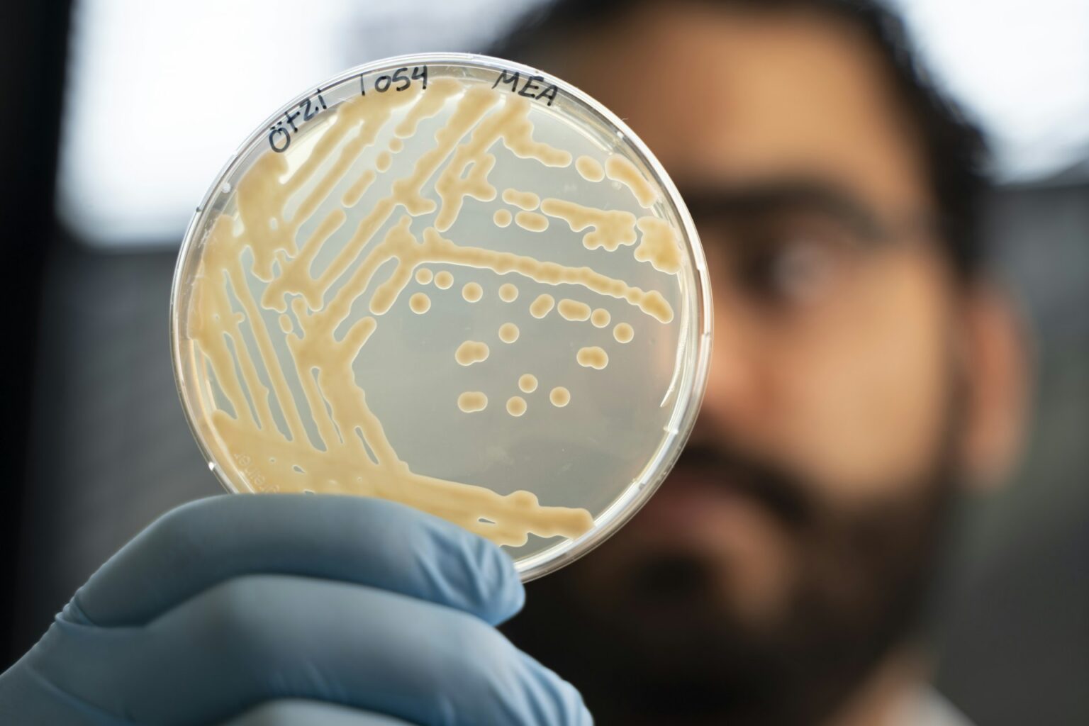 How the Iceman exposed the blind spots of pure metagenomics